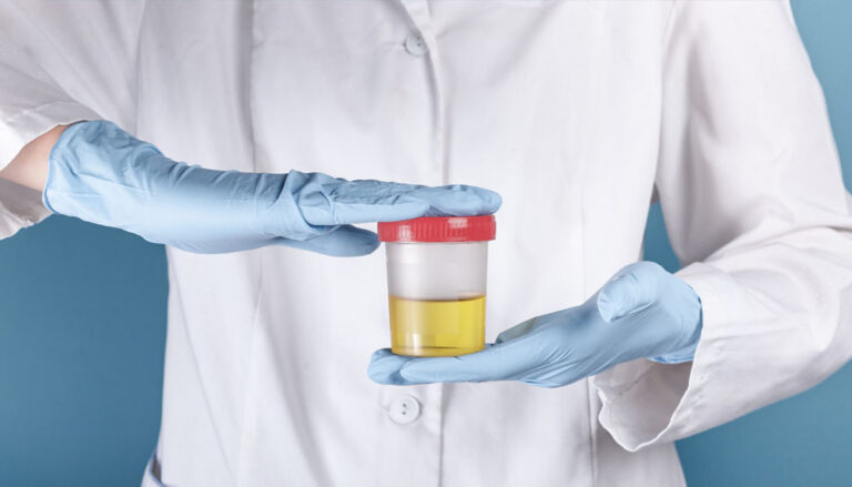 DOT Urine Tests: DOT Urine Tests: Guide for NYC & Elmont Drivers